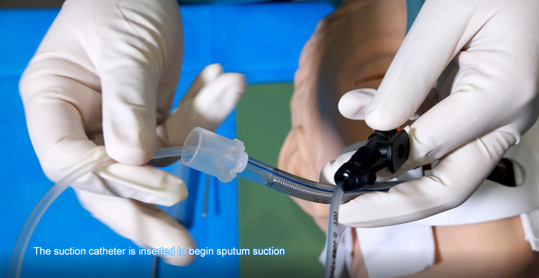 Customizable Sterile General Anesthesia Endotracheal Tube Kit ...